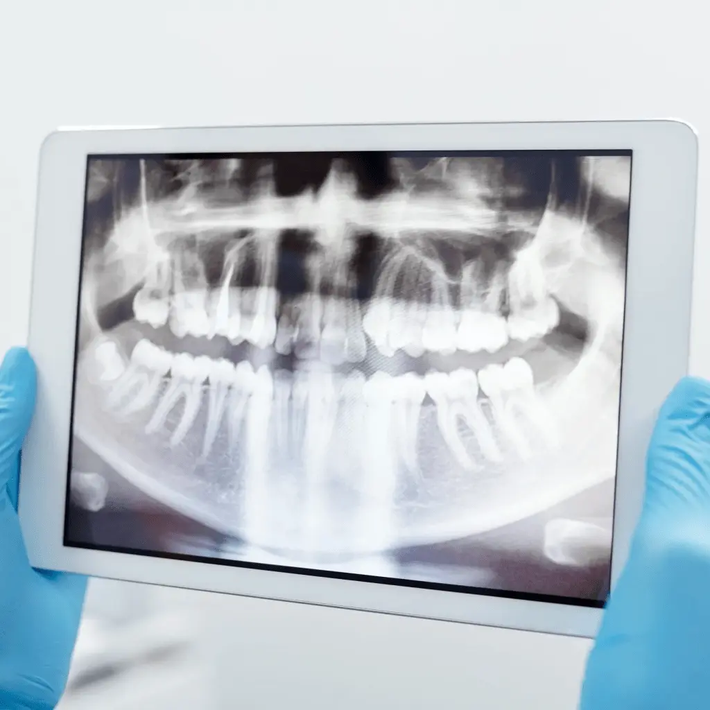 Digital Imaging Chicago | Sigma Dental Clinic